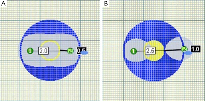 RTL late night uitzending met Hester Scheffer met informatie over de ...