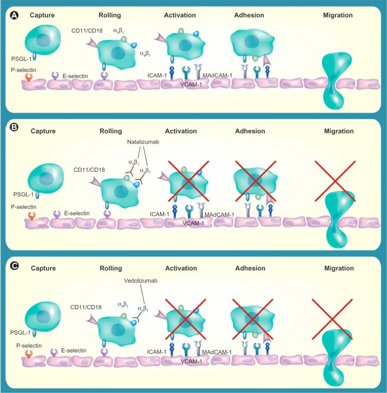 Vedolizumab voorkomt en geneest ontstekingen in darmen en lijkt ...